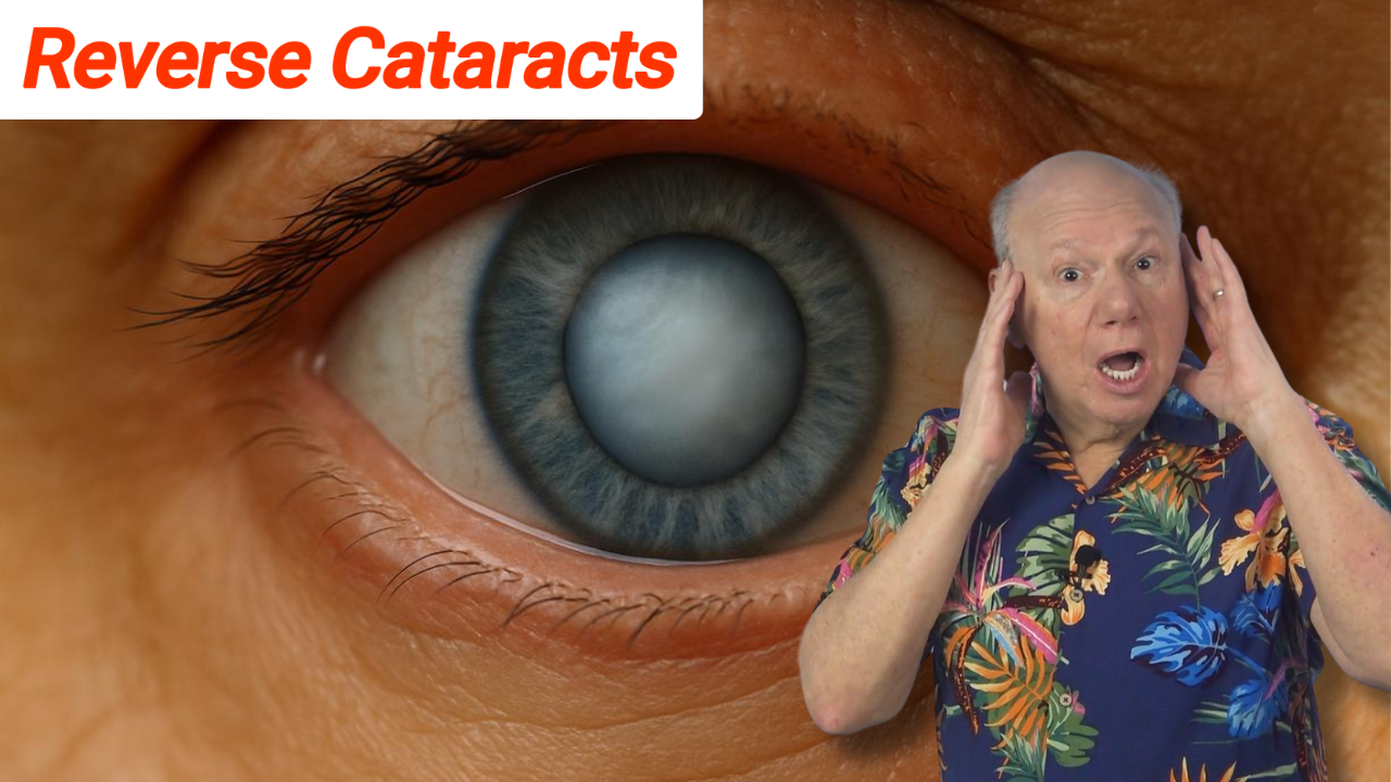 Reverse Cataracts Naturally – Dr Baritz