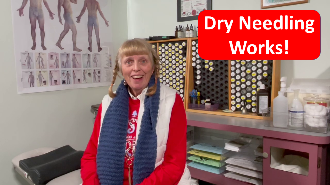 Dry Needling Works: Jane's Story – Dr Baritz