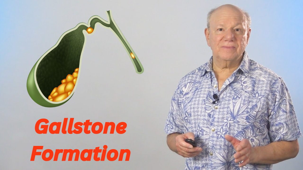 Unraveling the Process of Gallstone Formation – Dr Baritz